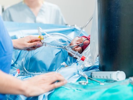 Cardiovascular Perfusion - Cardiovascular Perfusion